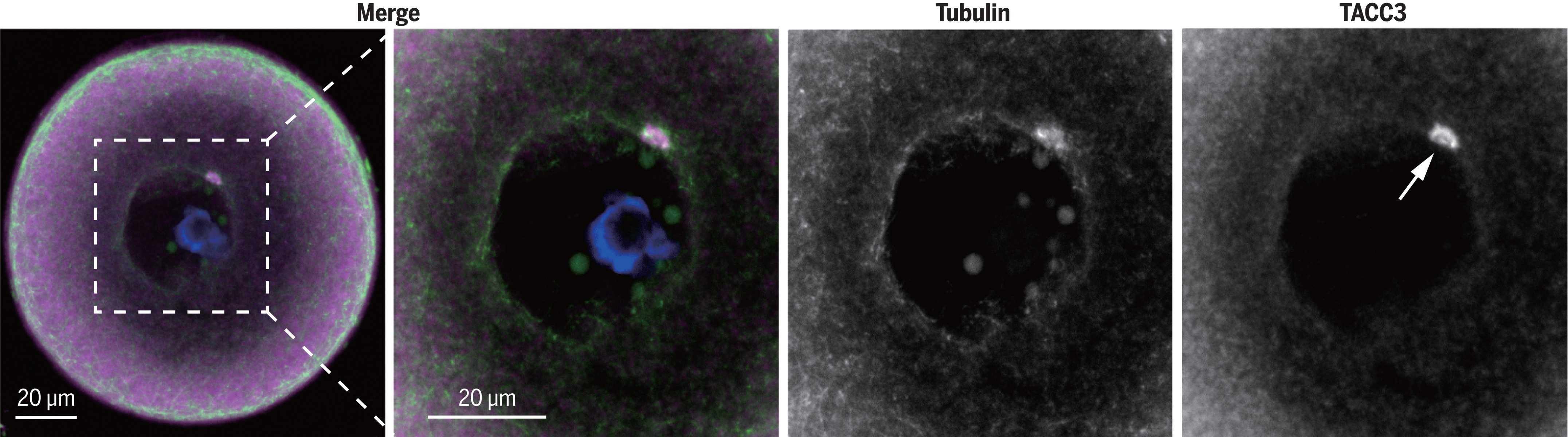 Lei Wang's Lab Uncover the mechanism of acentrosomal spindle assembly ...