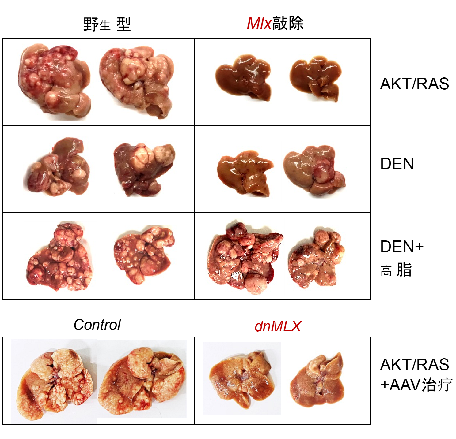 Oncogene| 余发星团队揭示ChREBP: MLX介导糖脂转化促进肝癌进展的机制及靶向策略